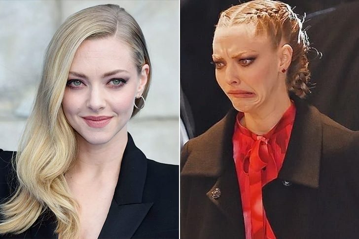 Unflattering Celebrity Pictures That Prove They Also Fall Victims To ...