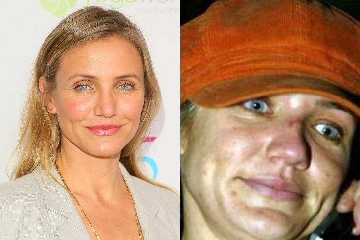 Unflattering Celebrity Pictures That Prove They Also Fall Victims To ...