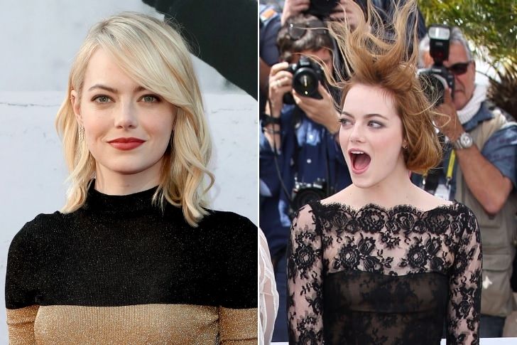 Unflattering Celebrity Pictures That Prove They Also Fall Victims To ...