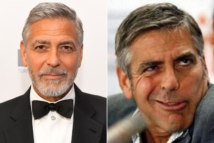 Unflattering Celebrity Pictures That Prove They Also Fall Victims To ...