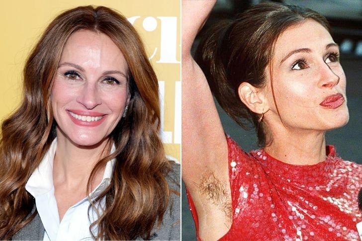 Unflattering Celebrity Pictures That Prove They Also Fall Victims To ...