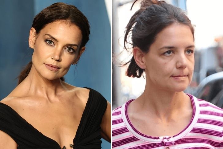 Unflattering Celebrity Pictures That Prove They Also Fall Victims To ...