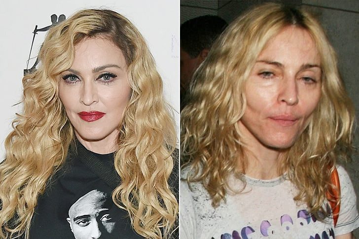 Unflattering Celebrity Pictures That Prove They Also Fall Victims To ...